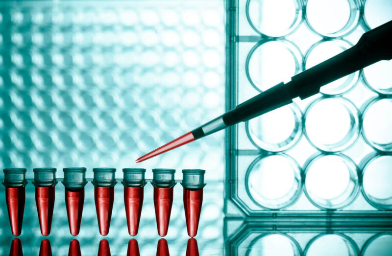 Your Health Blueprint: The Importance of Blood Tests at Sunrise ...