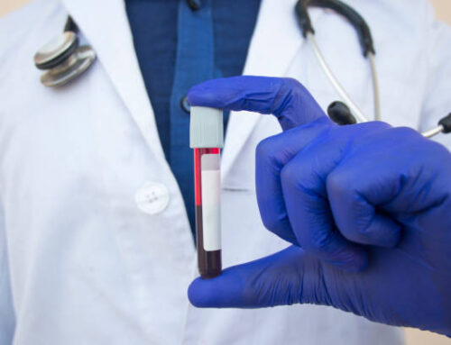 Understanding Bleeding Time Test, Clotting Time and Coagulation Test at ...