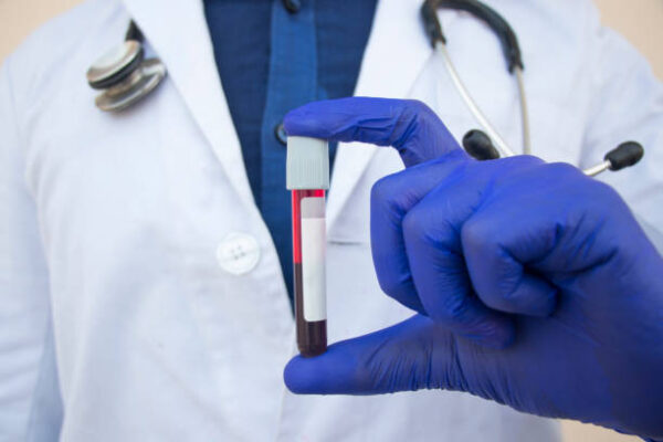 Blood Sample Collection and Testing at Sunrise Diagnostic Centre