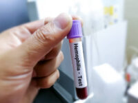 Hemoglobin Test: What It Is, Procedure & Results