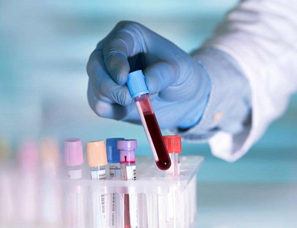 What is the difference between clinical laboratory and pathology ...