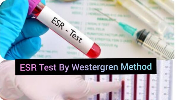 ESR Test | Purpose, Procedure & Normal Range Explained