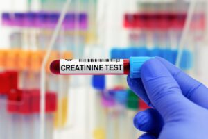 What Is a Creatinine Test? Normal Levels, Symptoms & Diagnosis